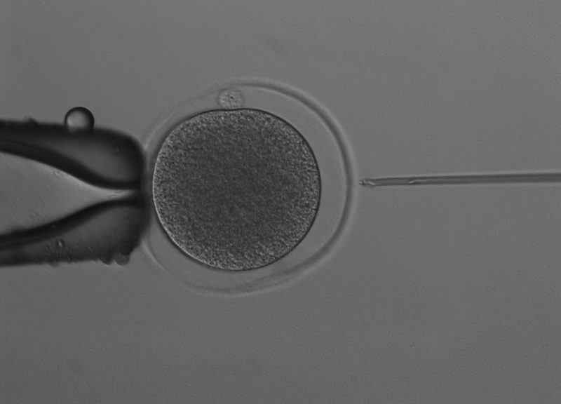 Scientists have produced a kangaroo embryo through IVF. It has sparked ...